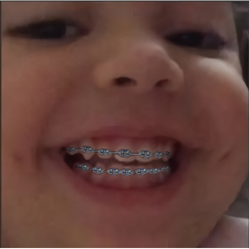 Sticker Maker - bracesF